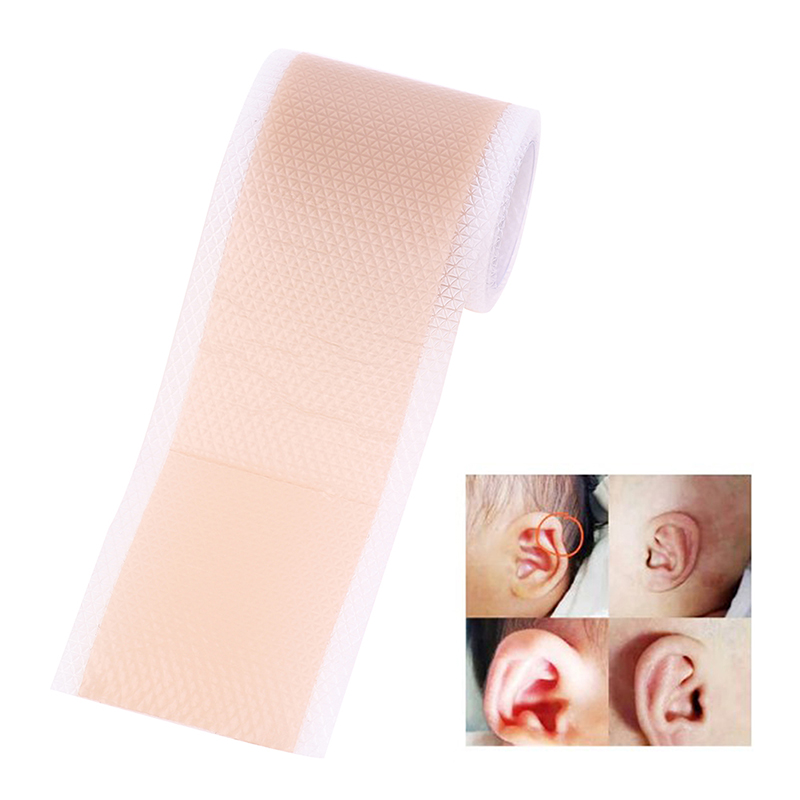 Newborn Baby Ear Correction Tape Ear Aesthetic Correctors Infant ...