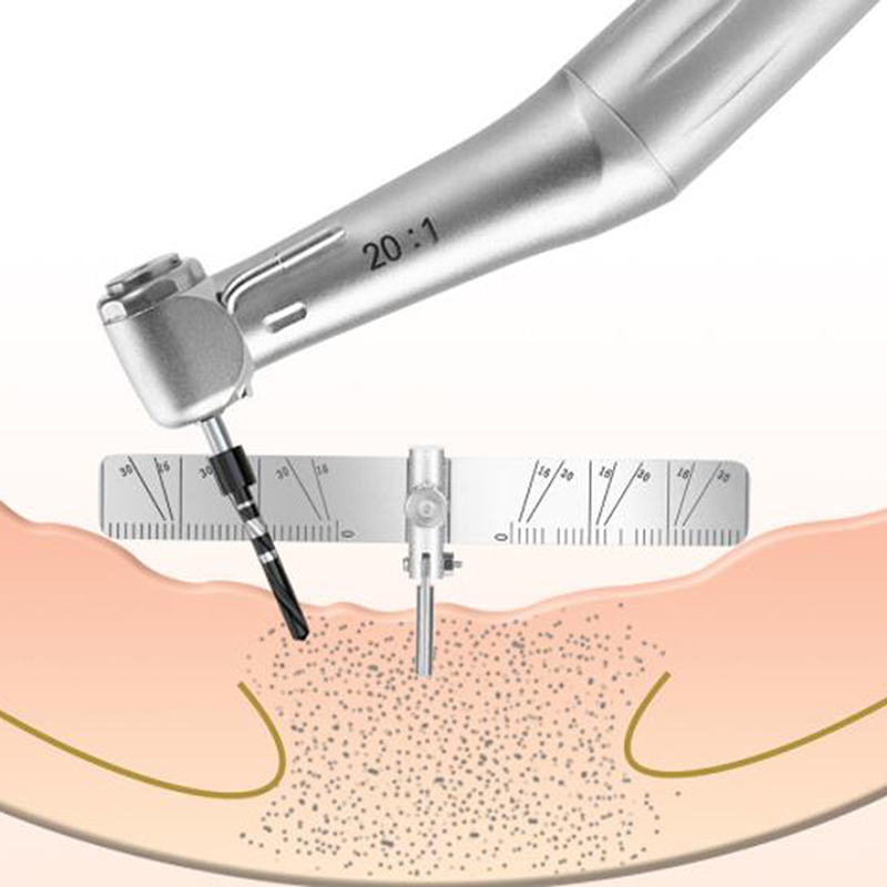 DENTAL IMPLANT LOCATING Guide Surgical Positioning Locator Angle Ruler ...